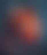 MPV Blood Test: Normal Ranges & Impact on Health