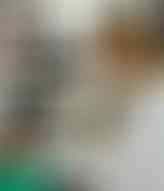 High Monocytes: Causes & Meaning of Elevated Levels