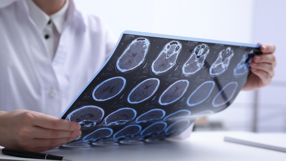 Understanding the Link Between Multiple Sclerosis and Bladder ...