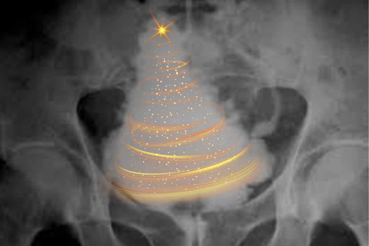Christmas Tree Bladder: The 'Gift' that Keeps You Going? - Jude