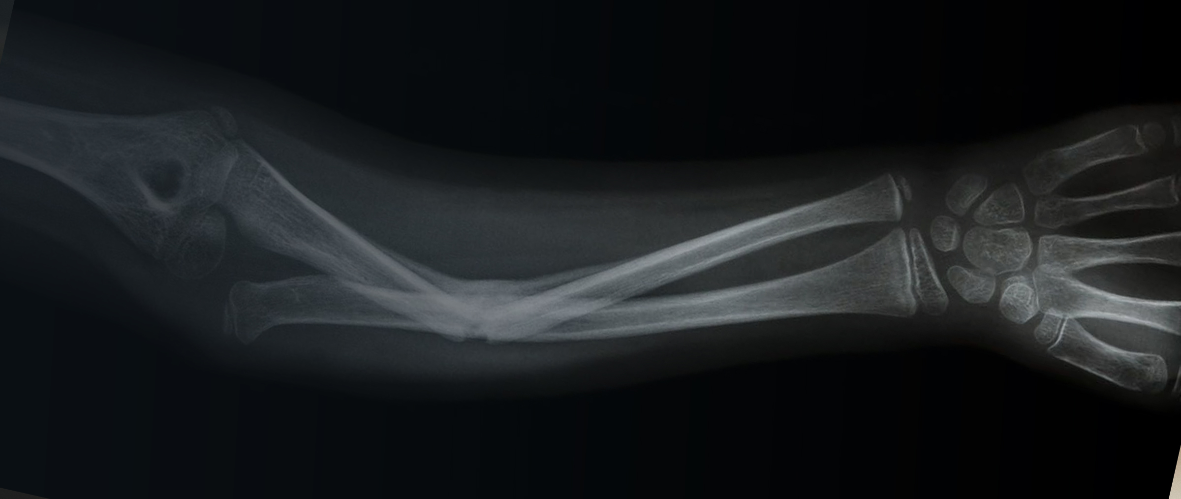 Personal Injury Software | LEAP Legal Software