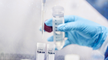 Roche | What is a liquid biopsy?