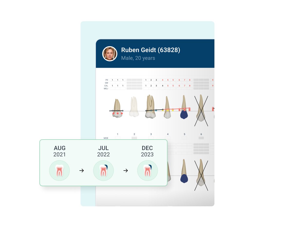 Periodontal Charting