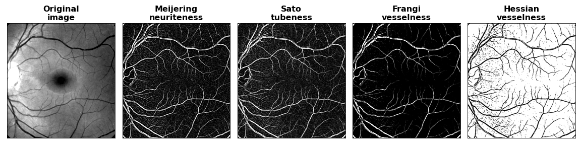 RAPIDS cuCIM: Porting scikit-image Code to the GPU | Quansight