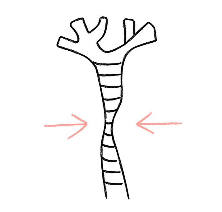 Collapsed trachea in dogs | ManyPets