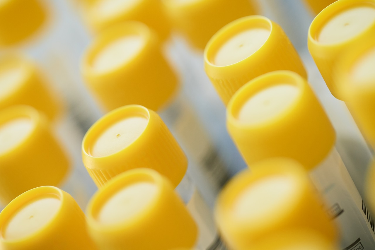 Notre Vision | Roche