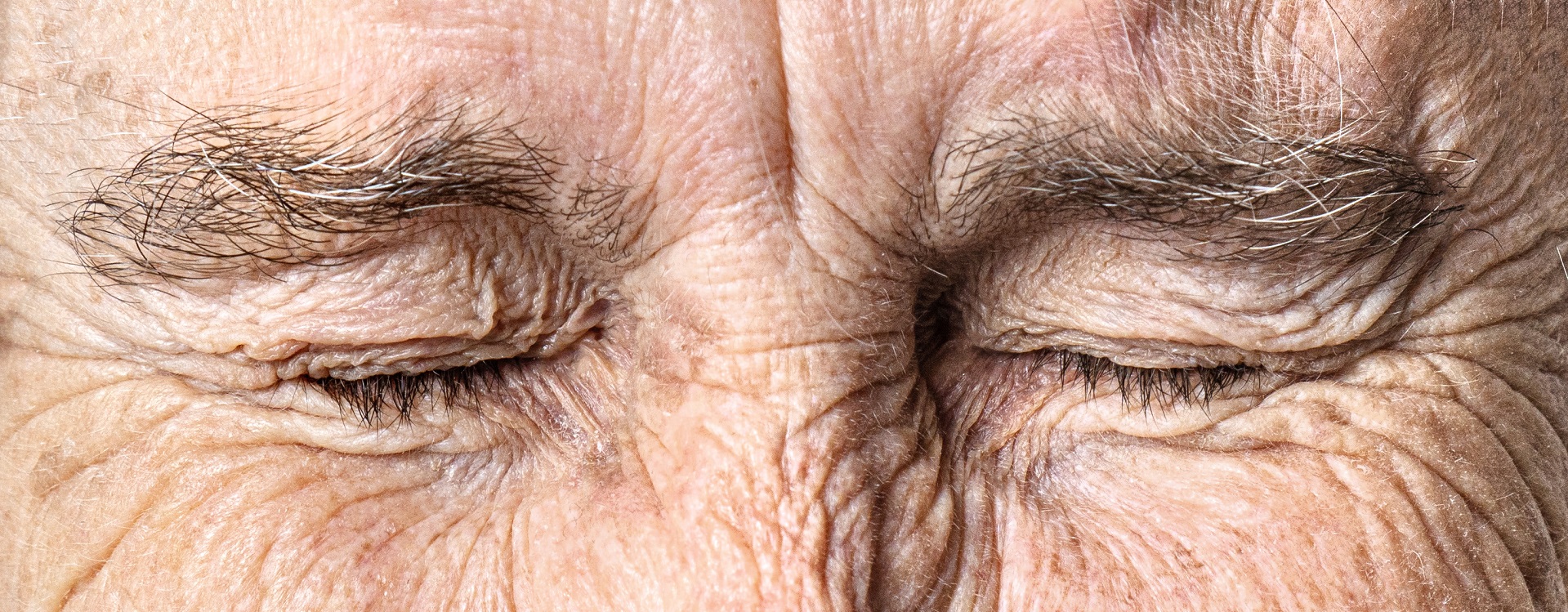 Est-il possible de stopper l’évolution de la DMLA