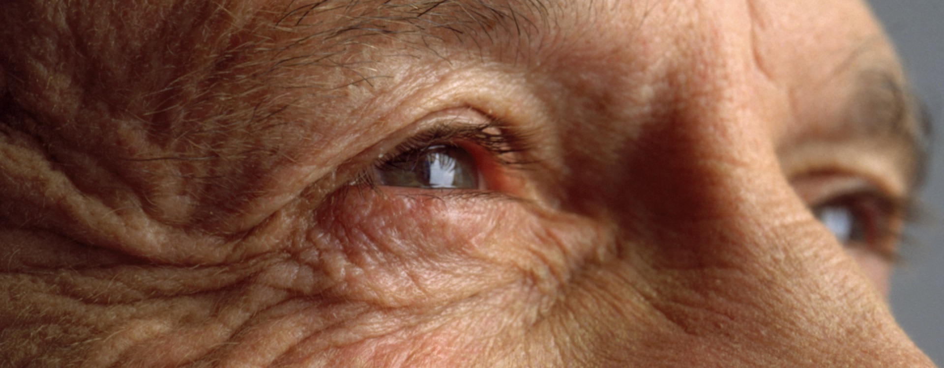 Roche | Comprendre la Dégénérescence Maculaire Liée à l'Âge (DMLA)