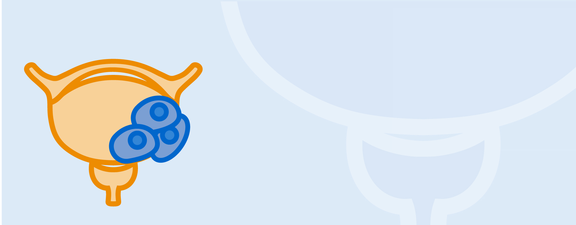 Facts about bladder cancer