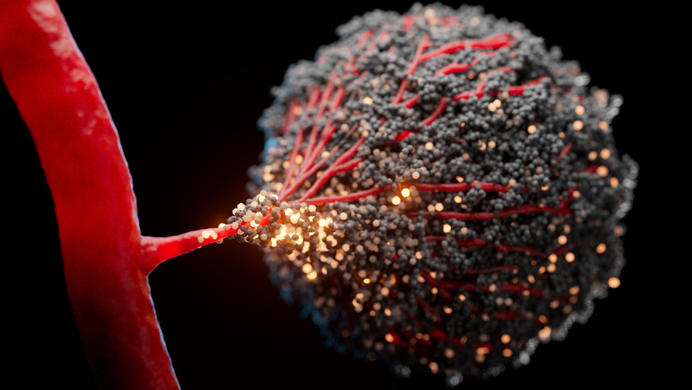 Nanopore Based Consensus Sequencing Enables Accurate Multimodal Tumour Cell Free Dna Profiling