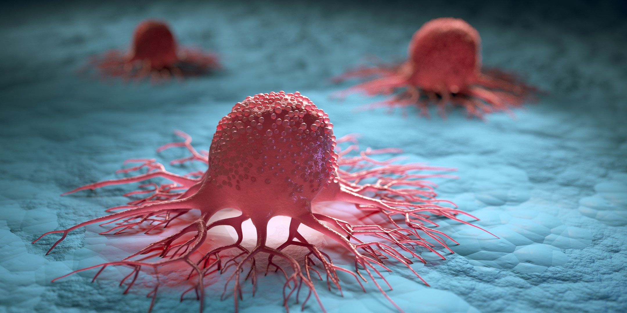 Structural Variation in Cancer