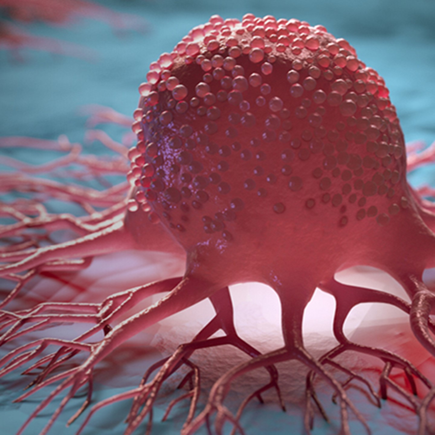 London Calling 2023 Precise Characterization Of Somatic Complex