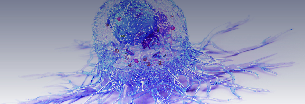 Precise Characterization Of Somatic Complex Structural Variations From Tumor Control Paired Long