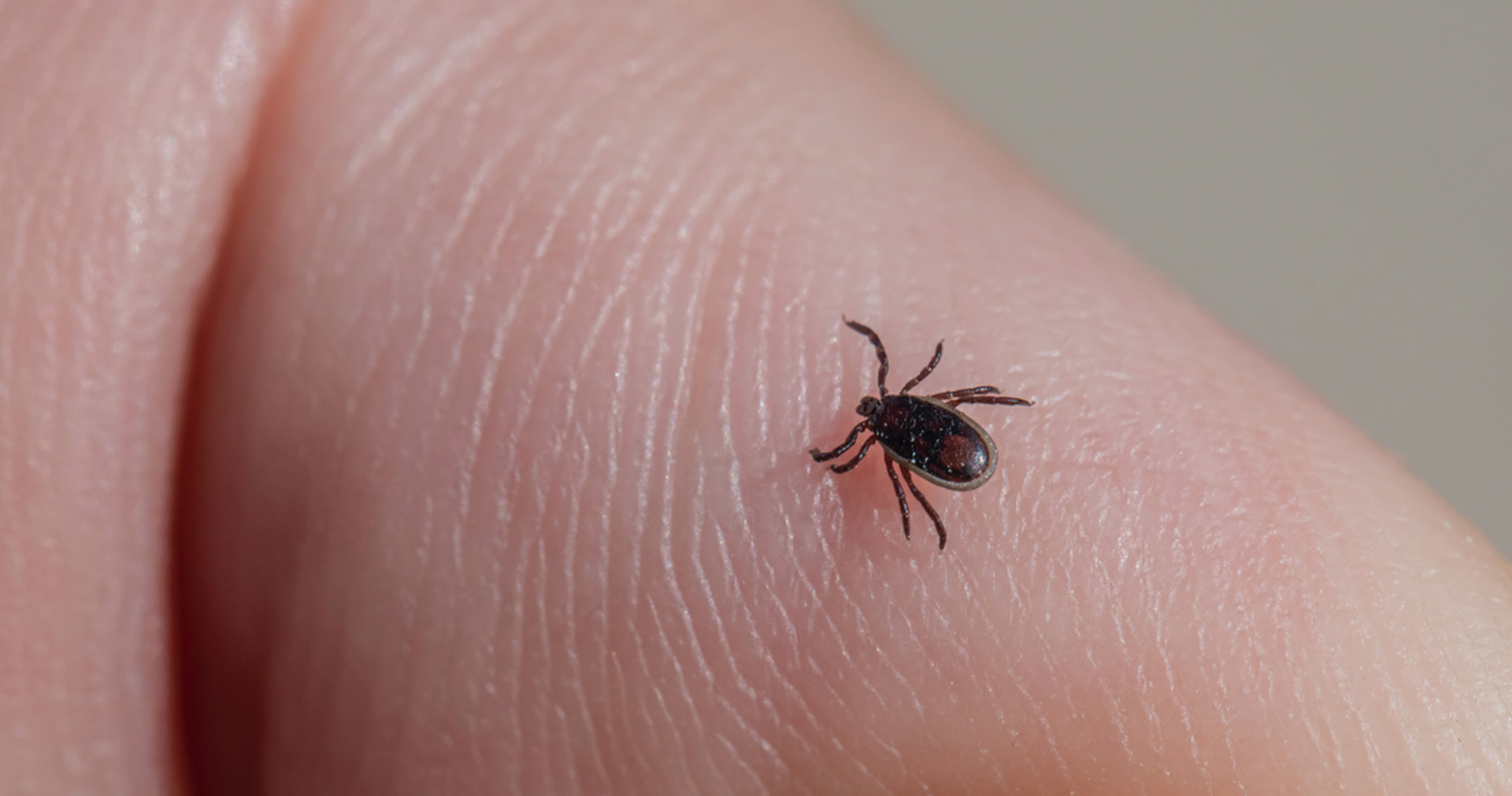 Lär dig de ovanliga symtomen på borrelia - Doktor.se