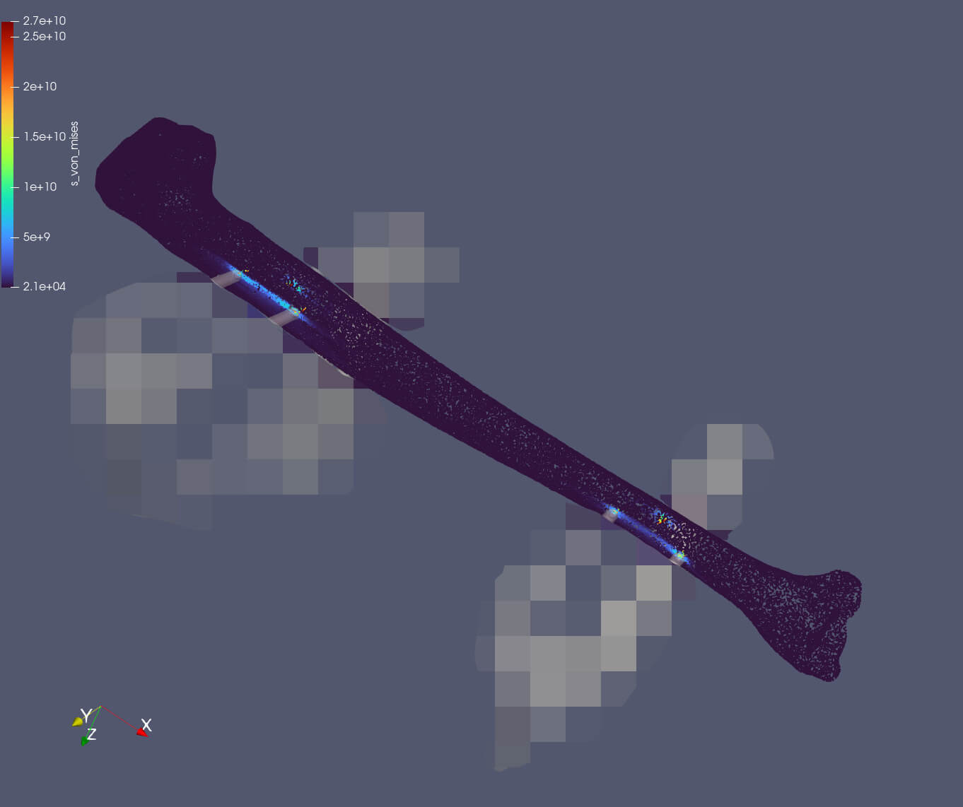 Boosting development of bone fixator prototype