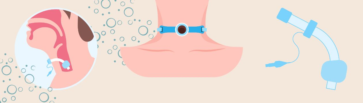 Schritte Zur Tracheostomie BMV® Tracheostomapflaster Spezial – BMV