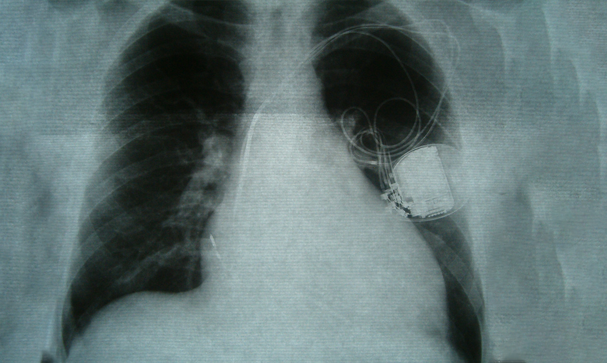 Novo Seeds portfolio company CorWave raises EUR 35m for breakthrough ...