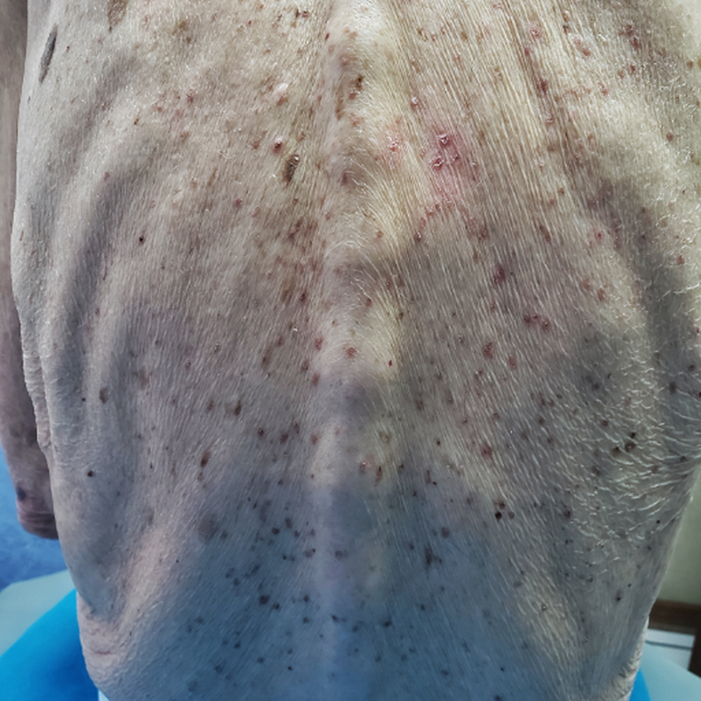 Petechien – Ursachen und mögliche Behandlungsmethoden