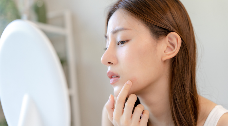 Welche Pickel-Arten gibt es und welche habe ich?