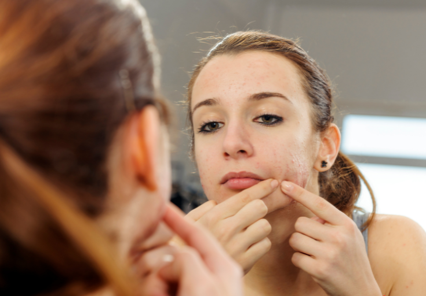 Welche Ursachen haben meine Pickel? – hier erfahren