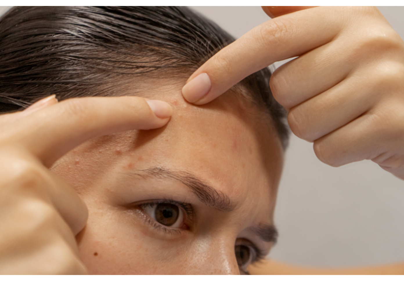 Pickel nach Körperstellen – so wirst Du sie wieder los