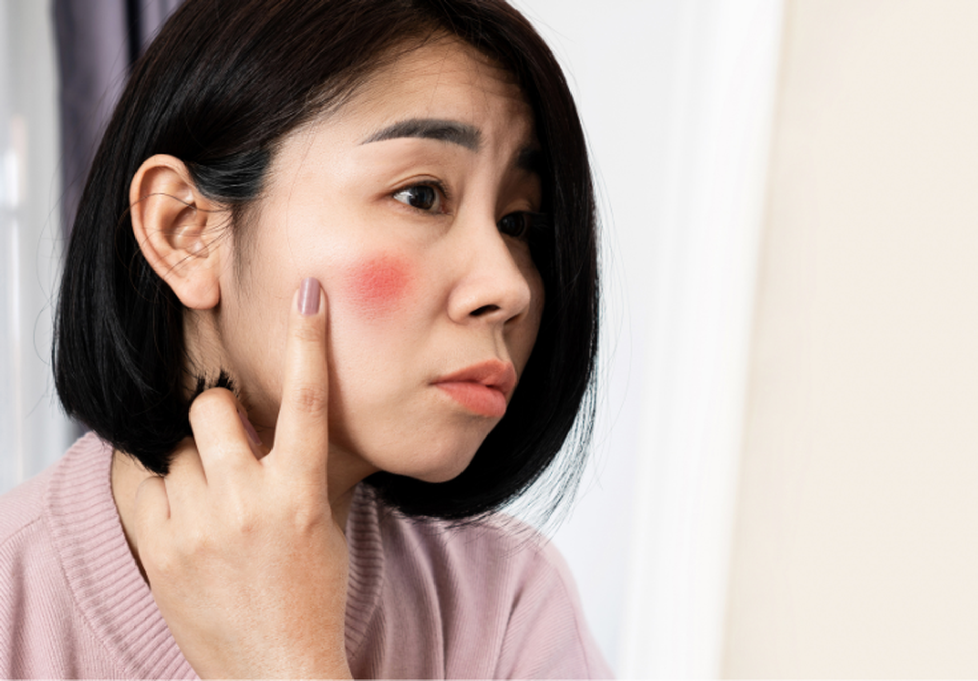 Rote Flecken im Gesicht – wirksame Behandlungsmethoden