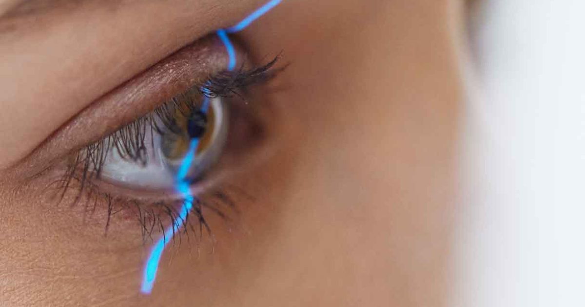 Intervento laser agli occhi Femto-LASIK: come si svolge e cosa sapere