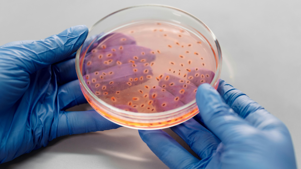 Escherichia coli: sintomi, contagio e quando prenotare una visita