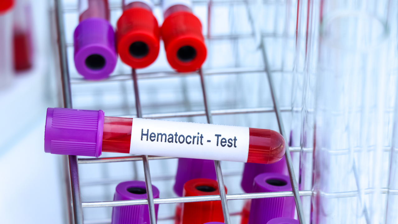 Ematocrito basso: cause, sintomi e quando preoccuparsi