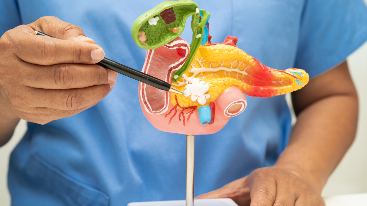 Calcoli biliari: sintomi, cause, cure efficaci e dieta per prevenirli