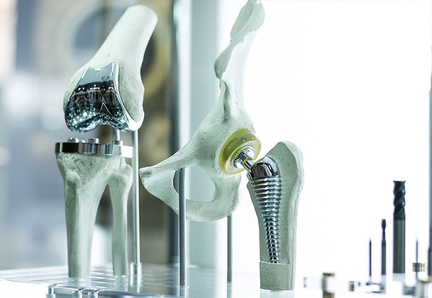 Bionische / biomeschanische Prothesen | Stadtwerke Düsseldorf