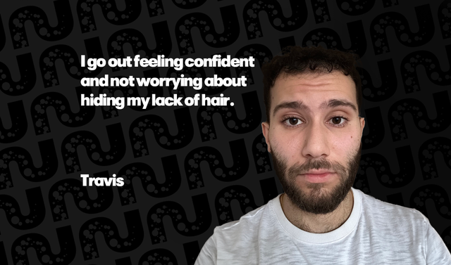 Hair growth with Numan: Travis’ story