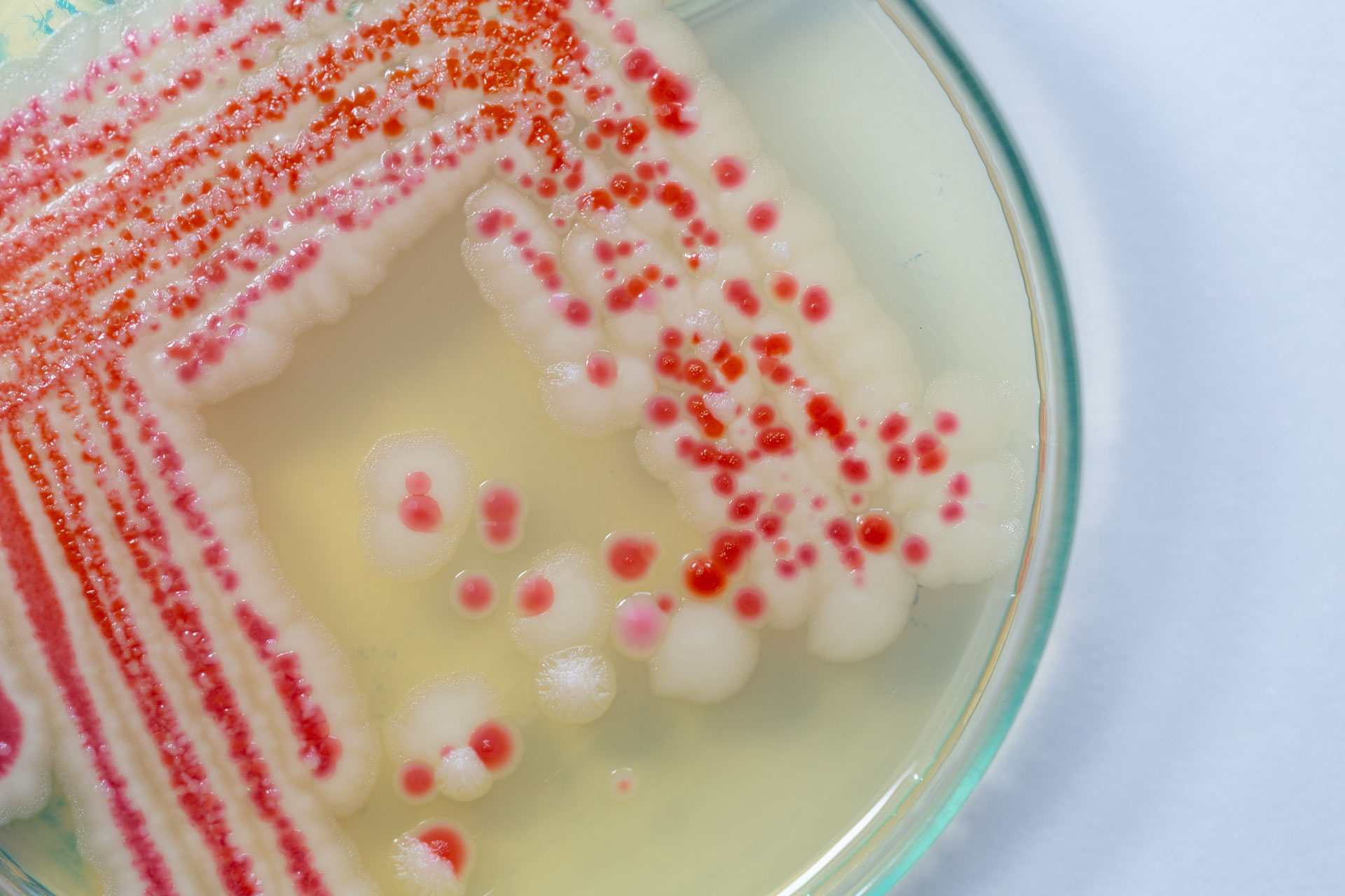 Understanding the Causes of Microbiological Pink Staining in Plastics ...