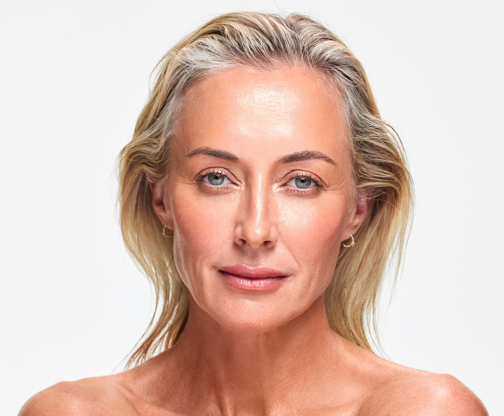 Profhilo® Structura Treatment | Laser Clinics New Zealand