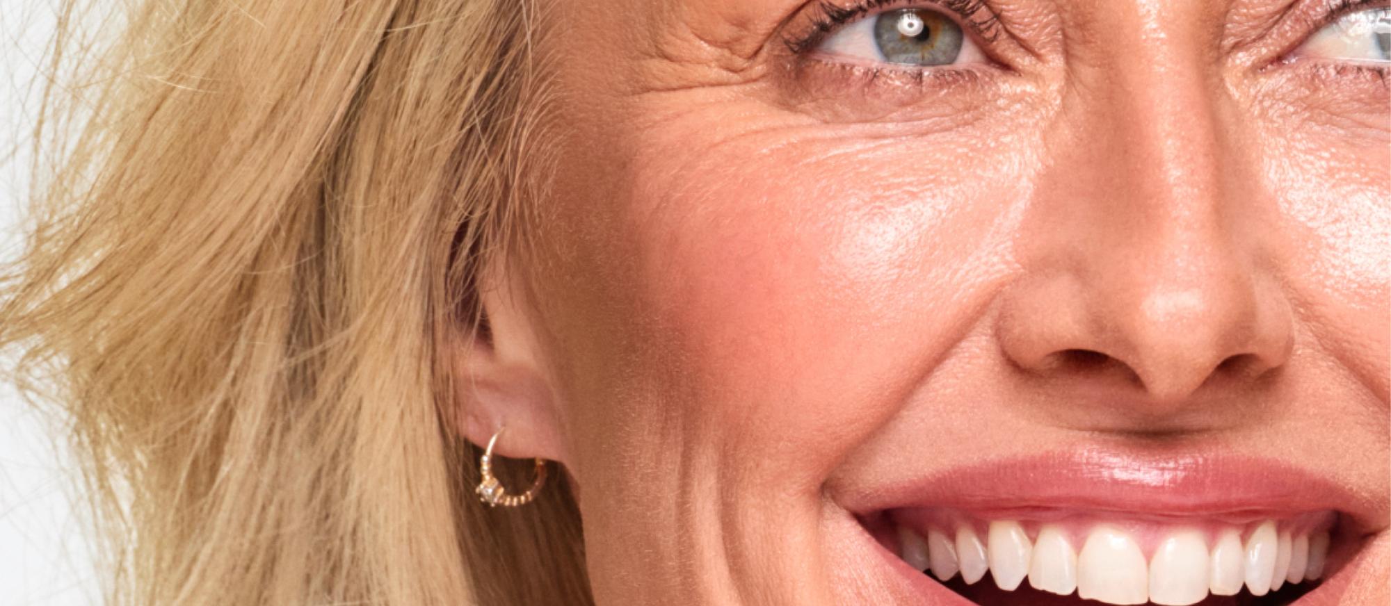 Polynucleotide Injectable Treatments | Laser Clinics United Kingdom