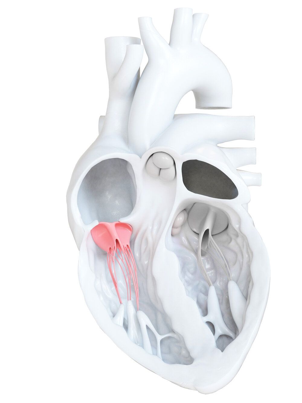 CroíValve Secures $16 Million in Series B Financing to Advance US ...
