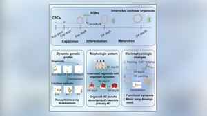 Scientists Create Inner-ear "Organoids" in Cell Cultures to Research ...