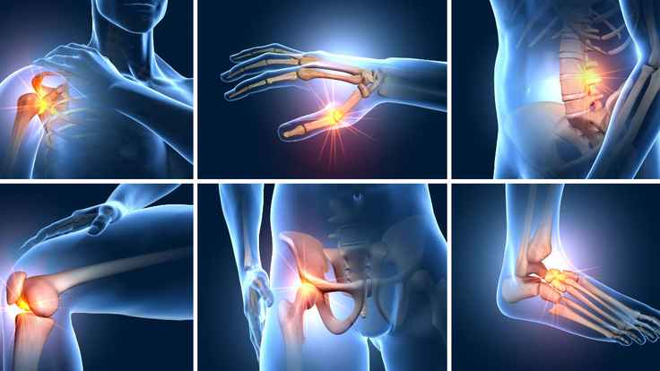 Inflammatory Arthritis, Autoimmune Disease, and Hearing Loss