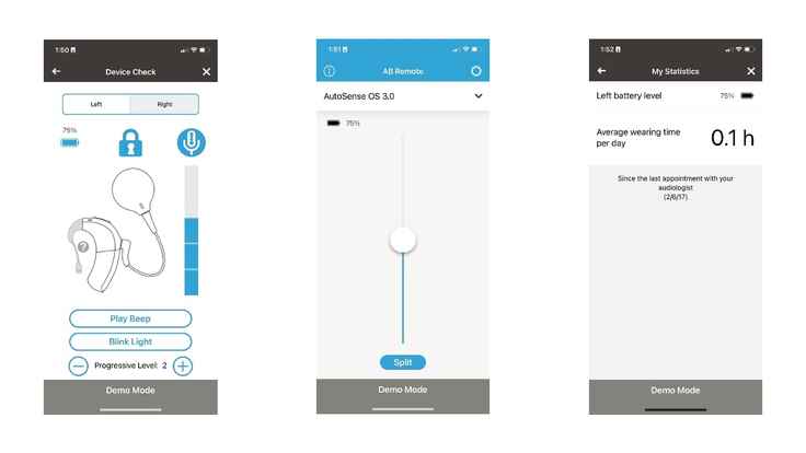 Advanced Bionics Cochlear Implant System