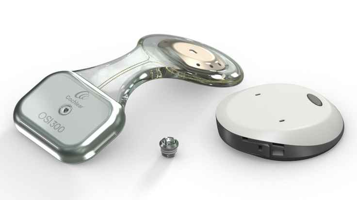 Cochlear Ltd Introduces New Osia OSI300 Bone Conduction Implant System ...