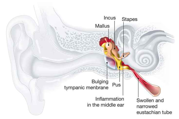 What is Tympanometry?