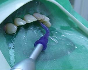 User Report Prozone | W&H