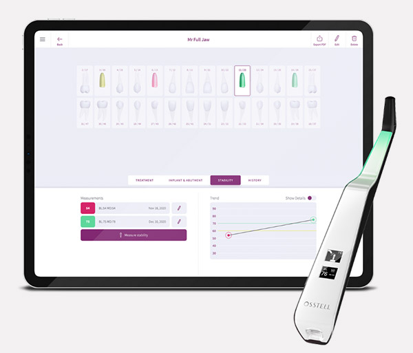 Osstell Beacon | W&H