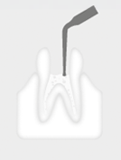 Piezo Endo Tips | W&H