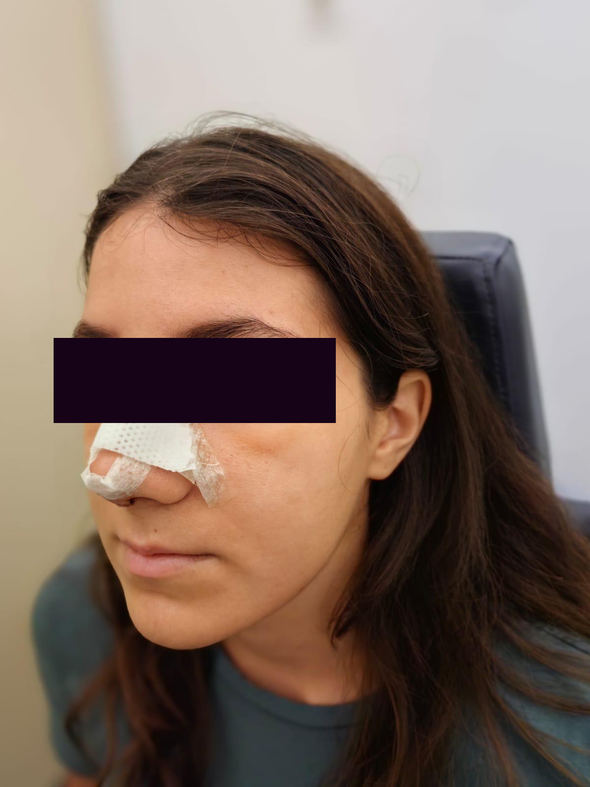 W&H Med | Piezo surgery: an alternative to conventional osteotomy