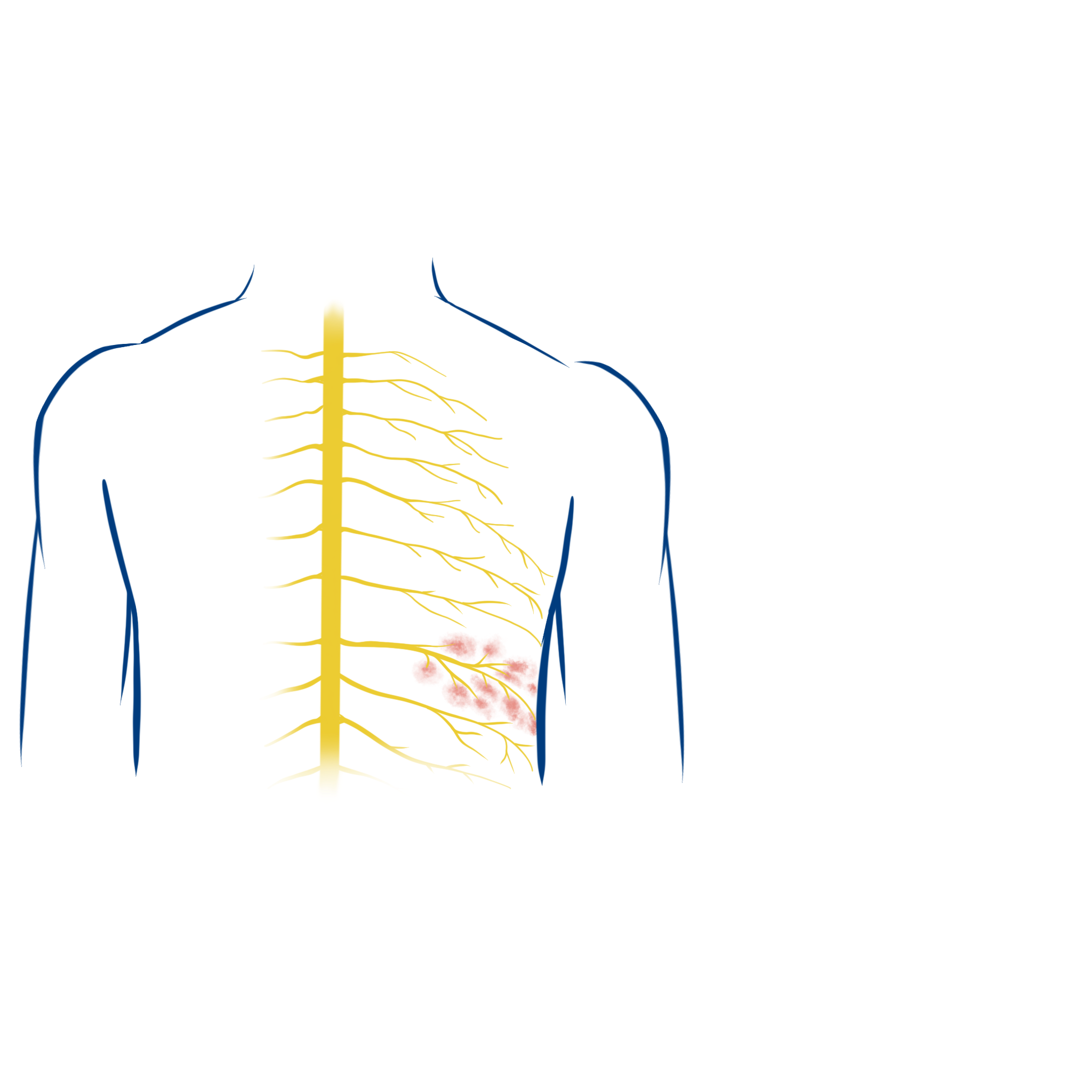 Wundrose Ursachen Symptome Behandlung Meine Gesundheit Erysipel