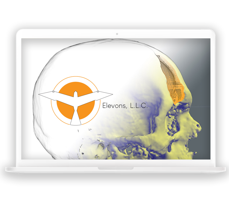 Grasshopper Partners | ShapeDiver