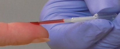 Collection & Transport of Blood Samples | UN3373 Compliance