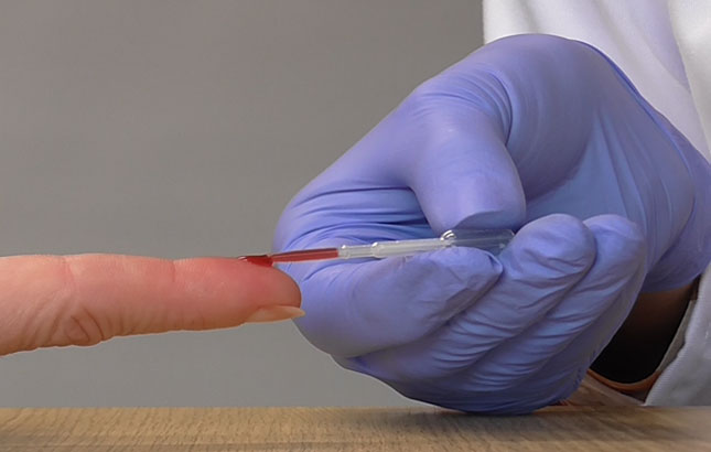 Blood Sample Collection Solutions | Alpha Laboratories