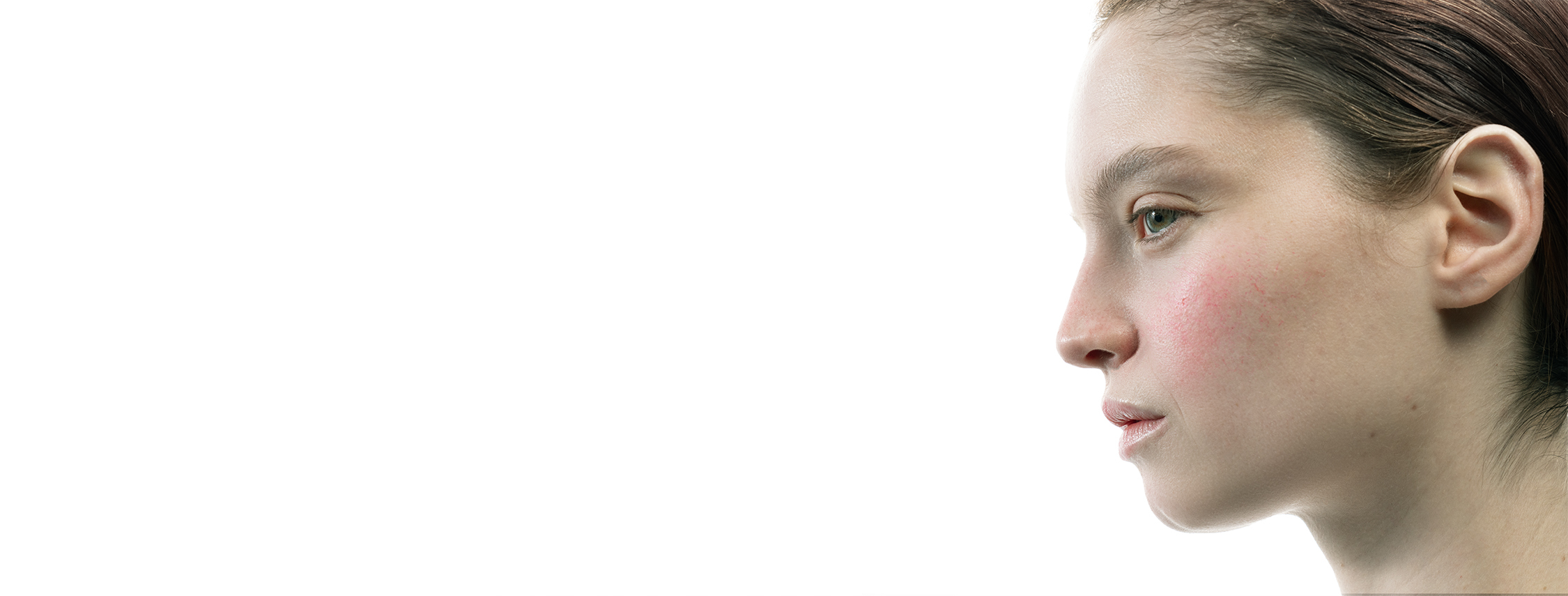 Soins contre les Rougeurs - Typology